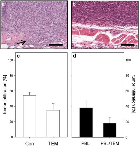 Hematoxylin Eosin Histology Of Ct26 Gfp Colorectal Tumor Cell Download Scientific Diagram