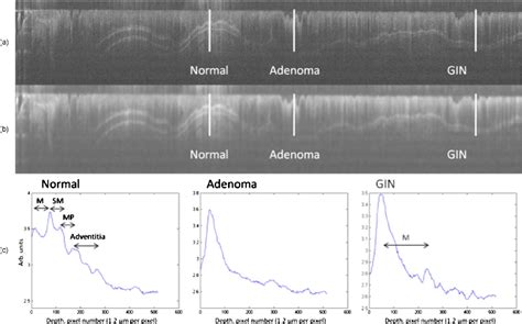 Figure From Quantitative Tool For Rapid Disease Mapping Using Optical Coherence Tomography