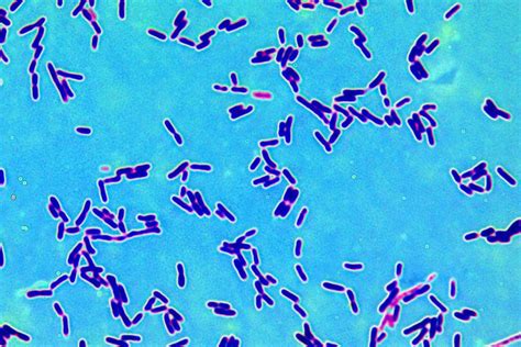 Halophilic Bacteria Definition Characteristics And Examples