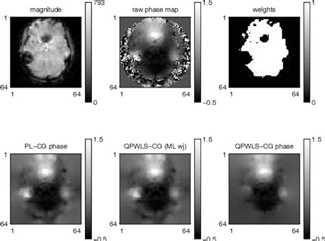 Figure 1 From Regularized Fieldmap Estimation In Mri Semantic Scholar