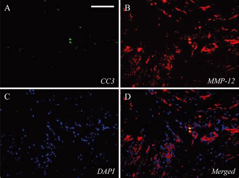 Immunohistochemical Staining For A Cleaved Caspase 3 Cc3 B