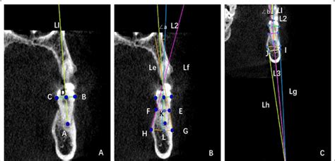 Data Measurement A The Long Axis Of The Tooth Was Determined By Download Scientific Diagram