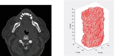 Figure 1 From Active Contour Based Segmentation Techniques For Medical Image Analysis Semantic