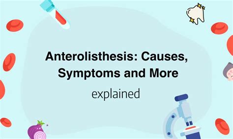 Anterolisthesis Causes Symptoms And More