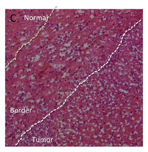 Raman Chemical Imaging In Tissues A A Representative Map Image Based