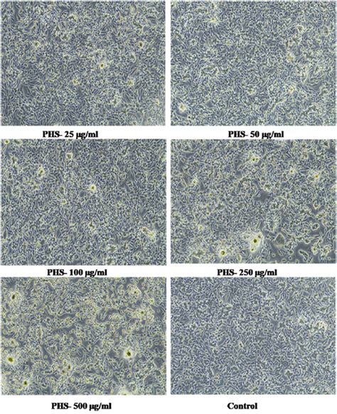 In Vitro Cell Viability Mtt Assay Of Polyherbal Syrup Formulation On