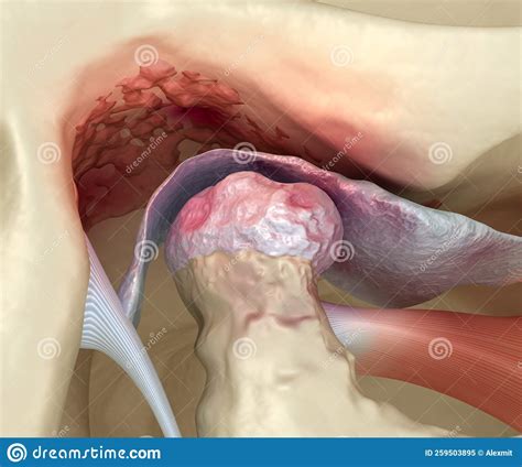 Tmj The Temporomandibular Joints Healthy Occlusion Anatomy Medically Accurate 3d Illustration