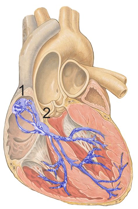 Left Bundle Branch Block Pathophysiology Wikidoc