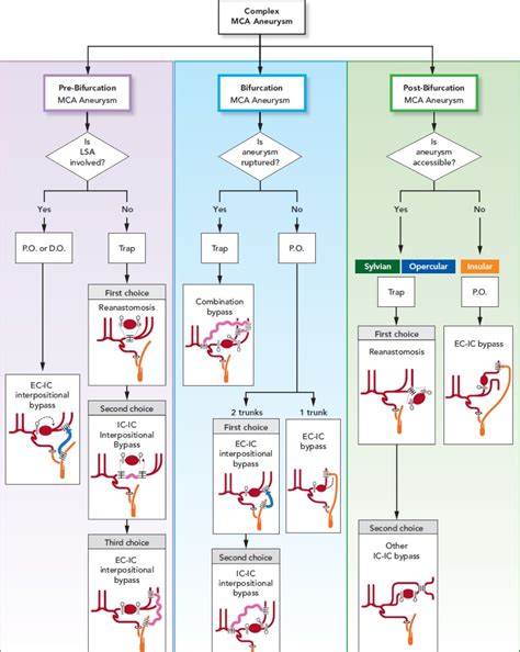 Mca Bypass Strategy Neupsy Key