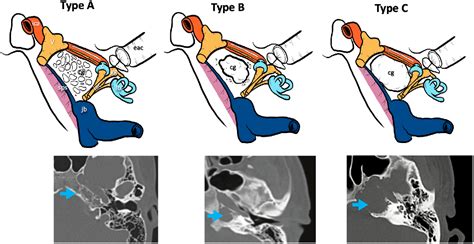 Figure 1 From Radiological Classification And Management Algorithm Of