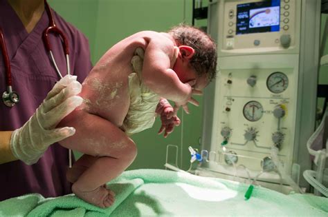 Umbilical Stem Cells Advantages And Disadvantages