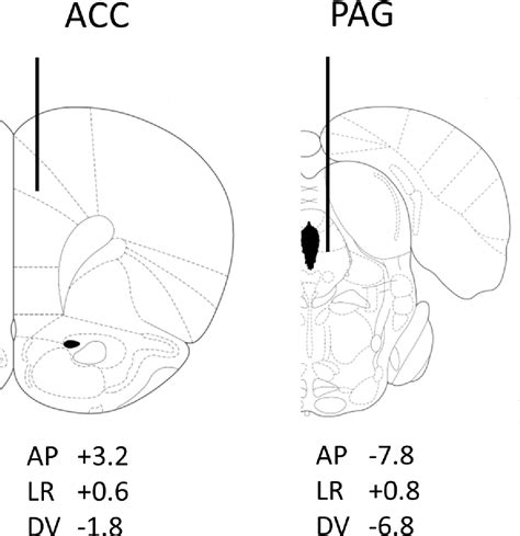 Figure 1 From Role Of The Anterior Cingulate Cortex In The Control Of Micturition Reflex In A