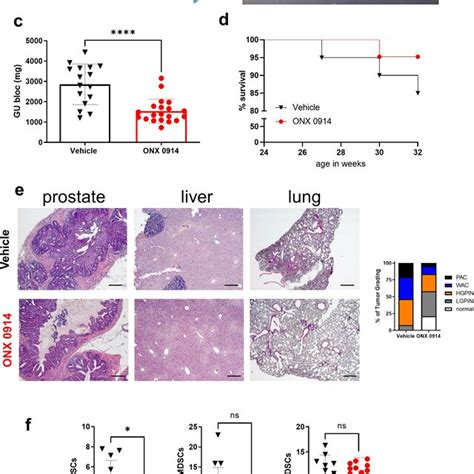 Inhibition Of The Immunoproteasome Interferes With Proteostasis And Download Scientific Diagram