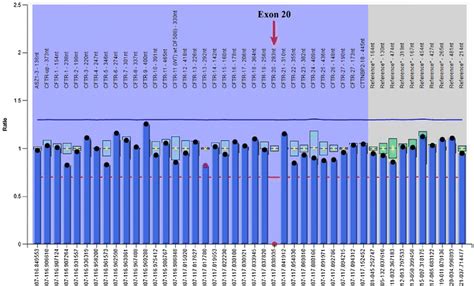 Mlpa Detected A Homozygous Deletion Of Cftr Exon 20 In The Patient The