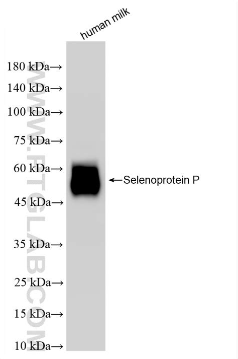 Selenoprotein P Antibody 85017 4 Rr Proteintech