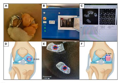 Figure 6 From A Rabbit Osteochondral Defect Ocd Model For Evaluation Of Tissue Engineered