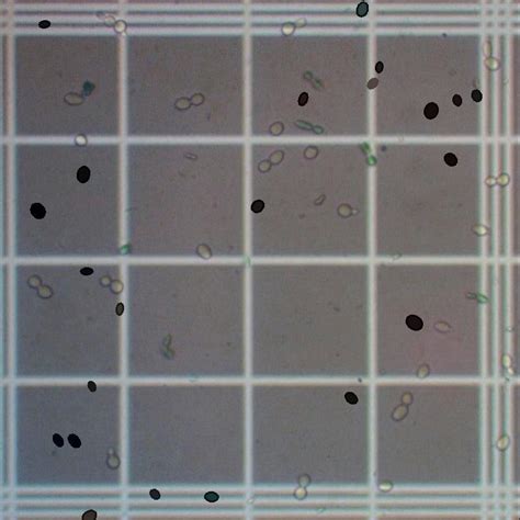 Yeast Deadcell Object Detection Dataset And Pre Trained Model By Aiml