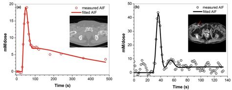 Figure 1 Comparison Of Arterial Input Functions Measured