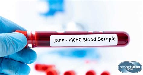 MCH MCHC Blood Tests Everything To Know 2025