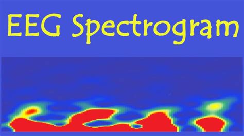 yuri beno phd on linkedin ieeg spectrum visualization interactive