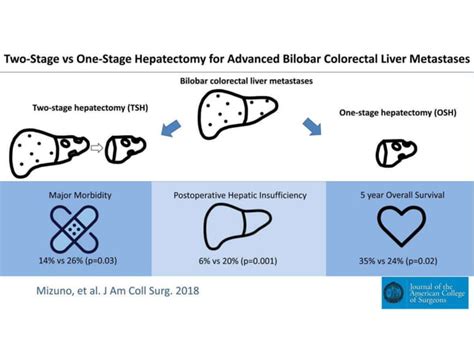 Multidisciplinary Approach To Colorectal Liver Metastases