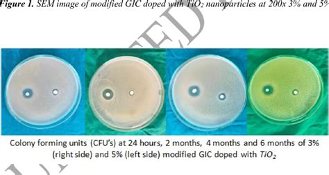 antibacterial activity of gic doped with tio2 nanoparticles on colony