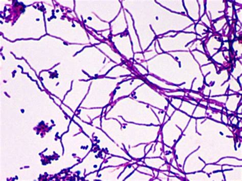 Microbiology Are Acid Fast Bacteria Gram Positive Or Gram Negative