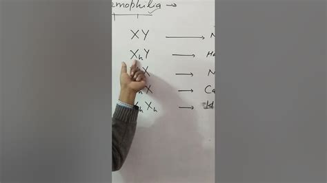 Haemophilia Bleeders Disease Sex Linked Disease Youtube