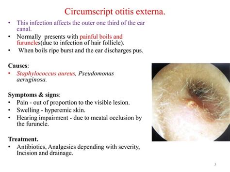 Otitis Externa On Human Ear Pathophysiology Pptx Ear Nose And Throat Conditions Diseases