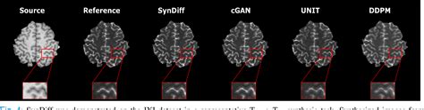 Unsupervised Medical Image Translation With Adversarial Diffusion Models
