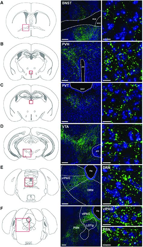 Axonal Projections Of Lh Lepr Neurons Schematic And Representative