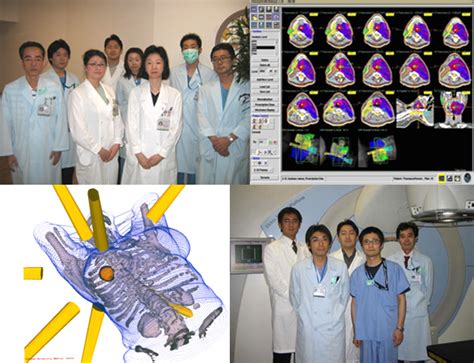 Juntendo Department Of Medical Physics For Advanced Radiotherapy Juntendo Department Of Medical Physics For Advanced Radiotherapy