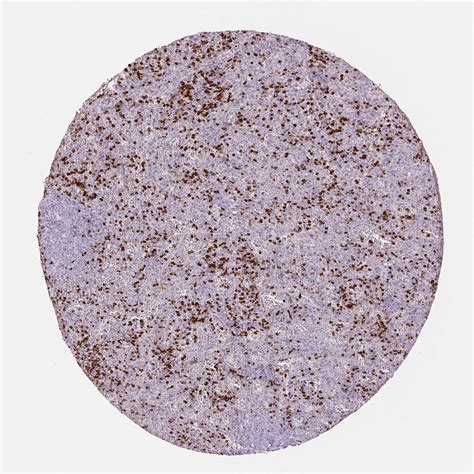 Tissue Expression Of Itgam Staining In Spleen The Human Protein Atlas