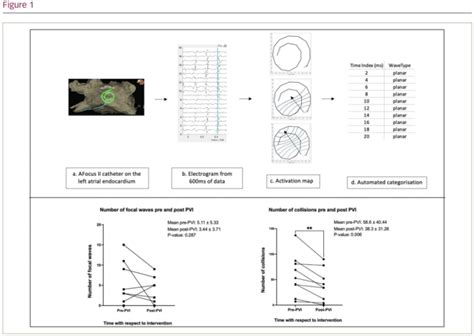 42 Retro Map A Novel Algorithm To Map Persistent Atrial Fibrillation