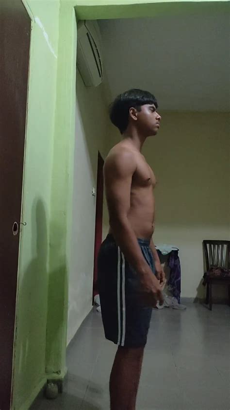 Uneven Back And Shoulder Rscoliosis