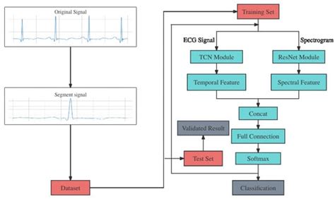 Atrial Fibrillation Detection With Single Lead Electrocardiogram Based