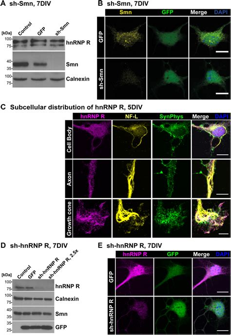 Subcellular Distribution Of Smn And Hnrnp R In Isolated Embryonic Download Scientific Diagram