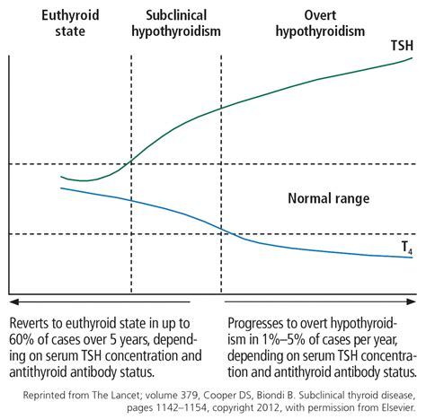 Subclinical Hypothyroidism When To Treat MDedge