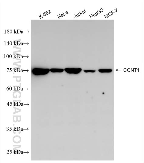 Cyclin T1 Antibody 84980 1 Rr Proteintech