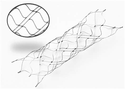 The Stent Demonstrates A Closed Cell Design With Alternating Columns Of Download Scientific