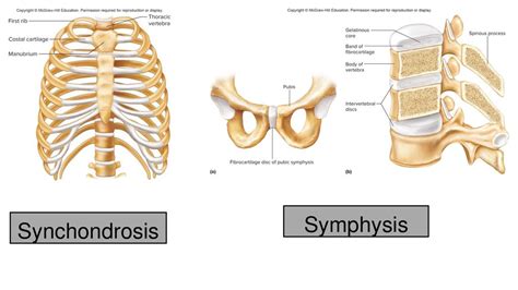 Ch 8 Joints Of The Skeletal System Ppt Download