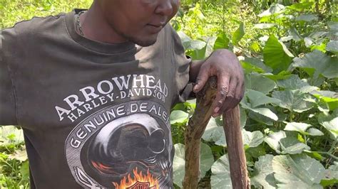 Jigger Digging Moffat Face And Feet With Edema Liver Cirrhosis Youtube