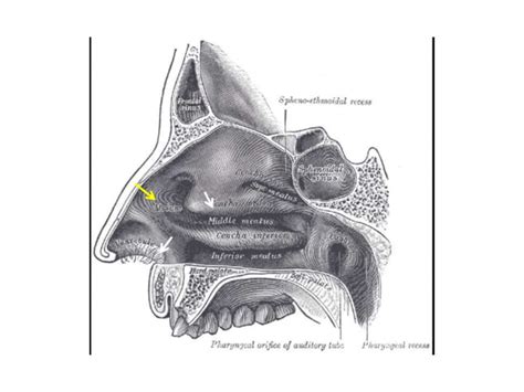 Development Anatomy And Histology Of Maxillary Sinus Pptx