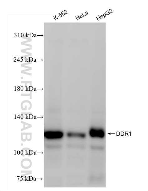 Ddr1 Cd167a Antibody 84438 6 Rr Proteintech