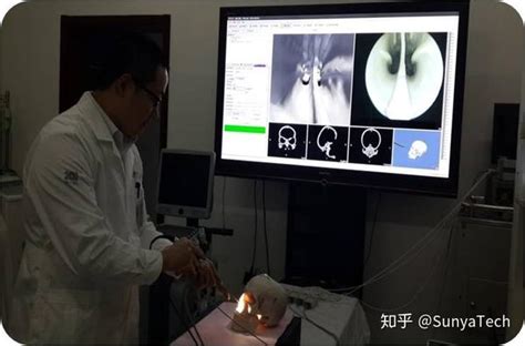 增强现实内镜手术导航教学系统 知乎