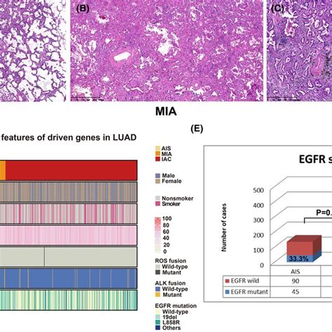 Clinicopathological Characteristics And Driver Gene Mutation Status Of