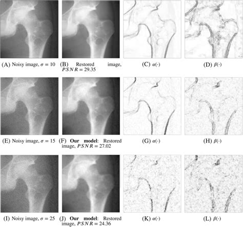 Image Restoration With Different Gaussian Noise Magnitude First Download Scientific Diagram