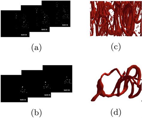 three slices from dataset 1 a before segmentation b after