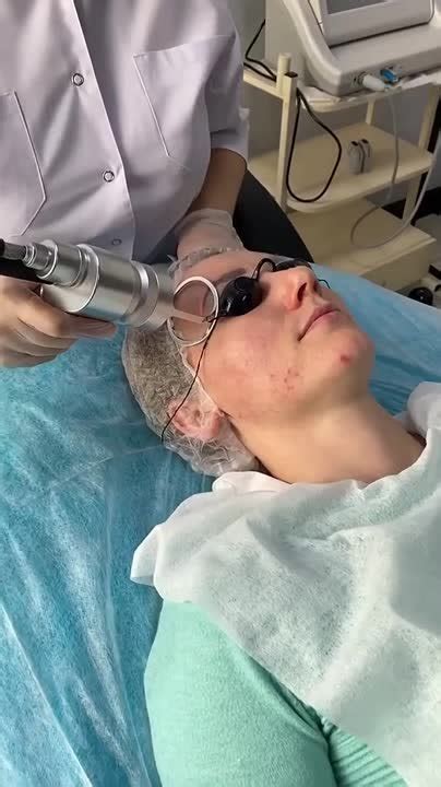 Лазерный фракционный аппарат FRAXOR — смотреть онлайн все 6 видео в ...