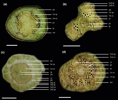 Stem Cross Sections Of Ipomoea Merremia Operculina And Stictocardia